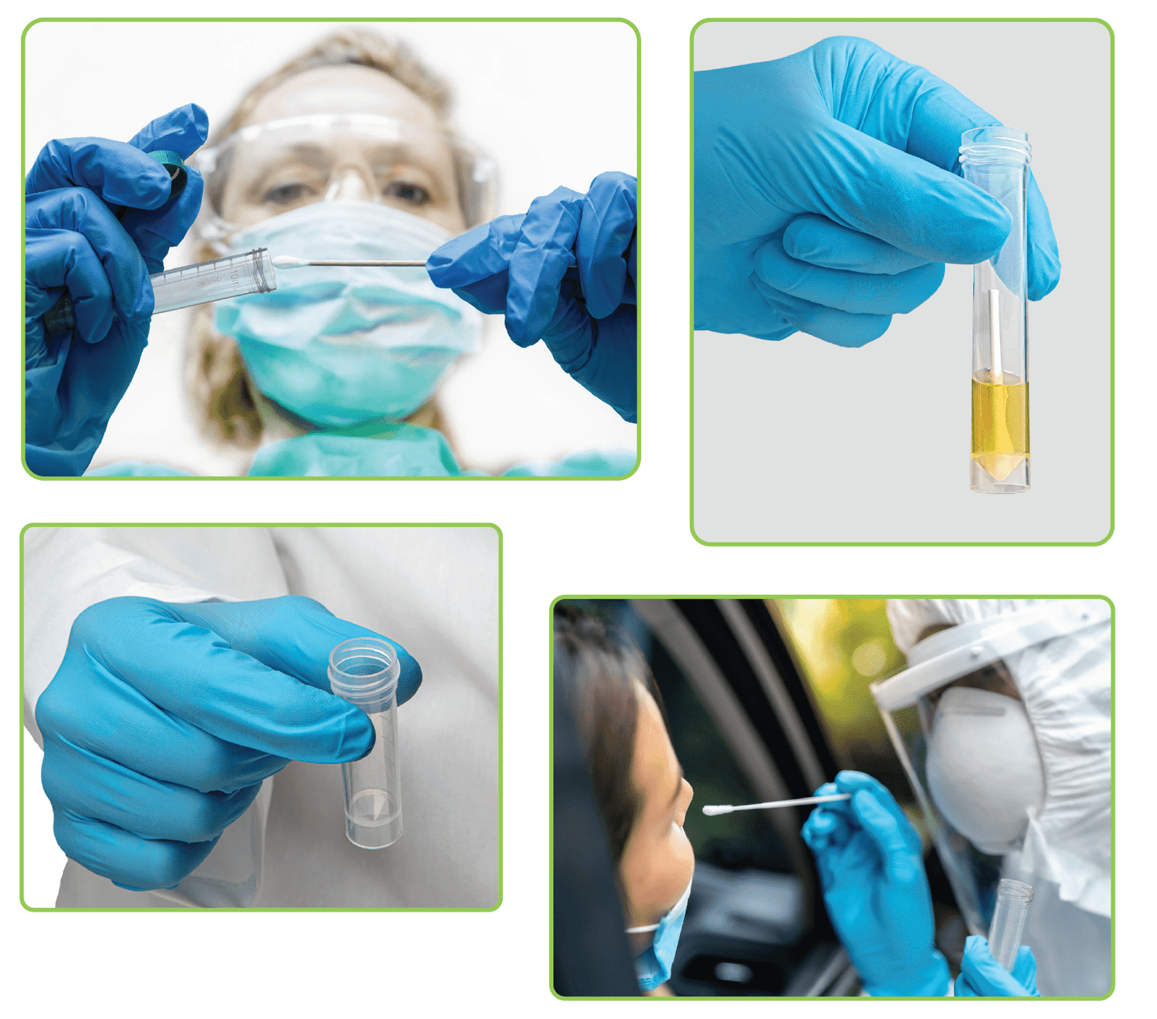 Labcon® Sample Collection and Transportation Tube (Sterile) | DBiomed ...